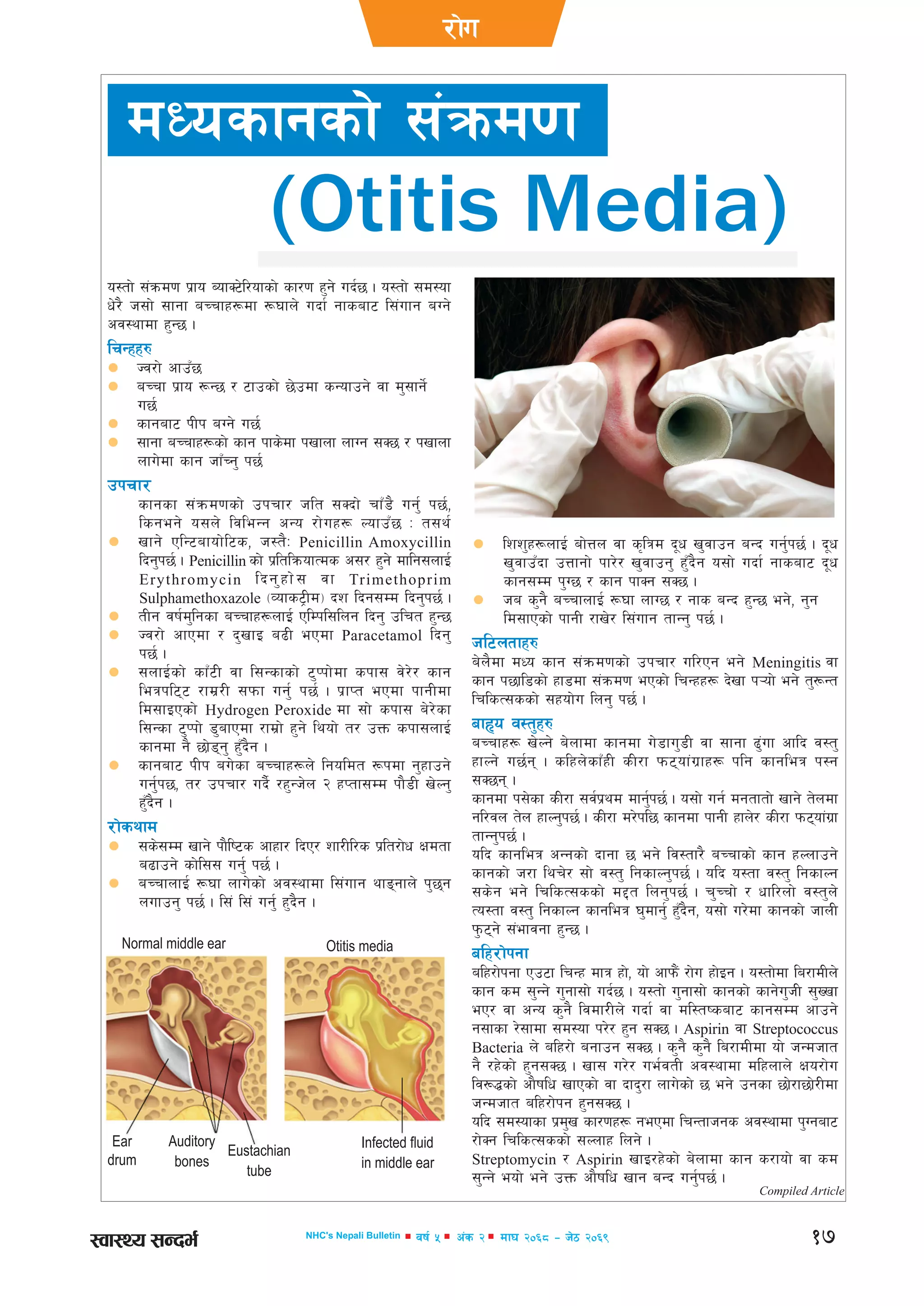 Otitis media CSOM | PDF