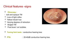 OTITIS MEDIA EFFUSION tube dysfunction -.pptx