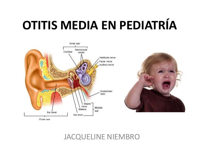 Otitis media en pediatría