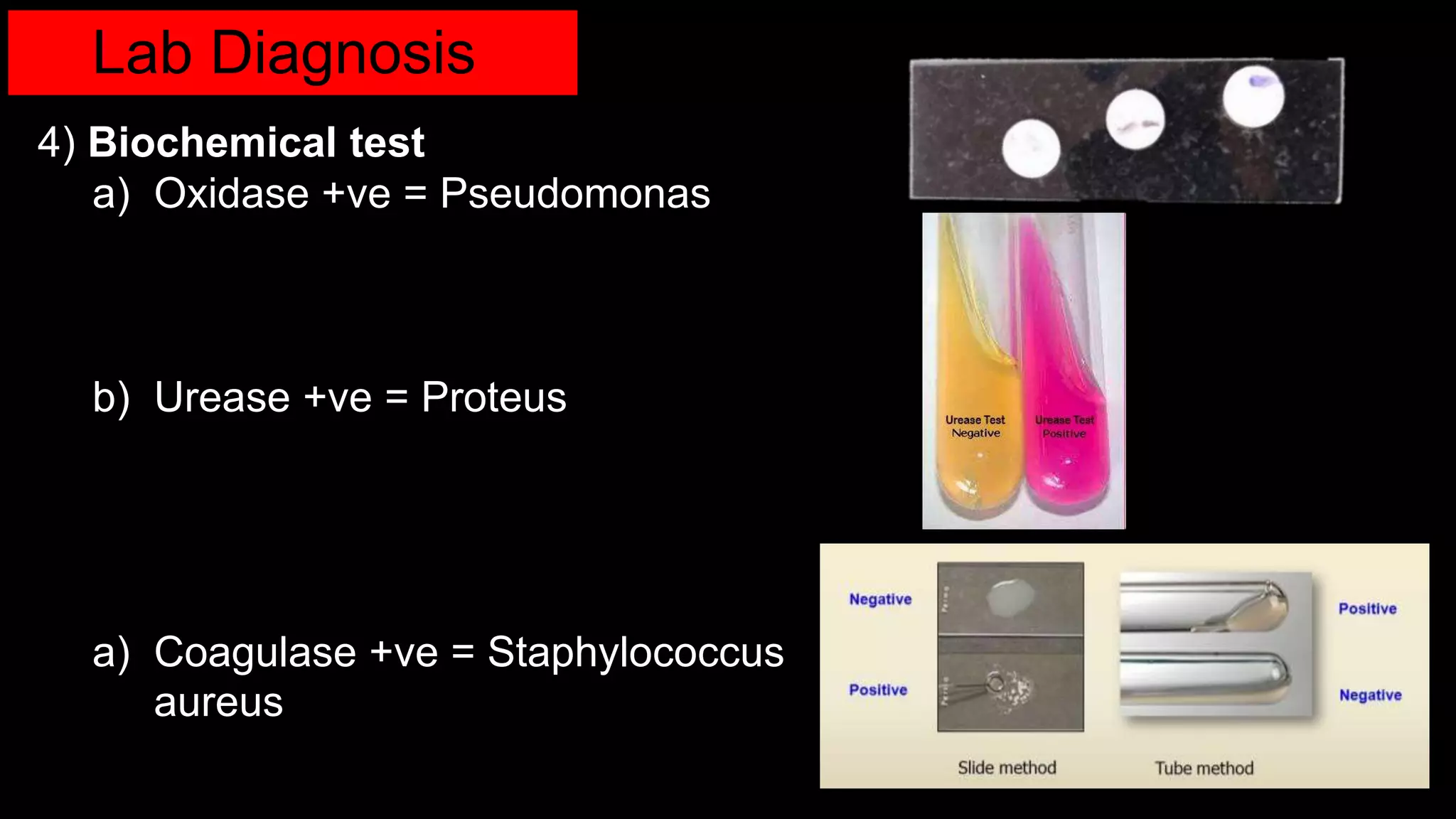 Otitis Media ENT and Microbiology | PPTX
