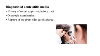 Otitis media in children | PPTX