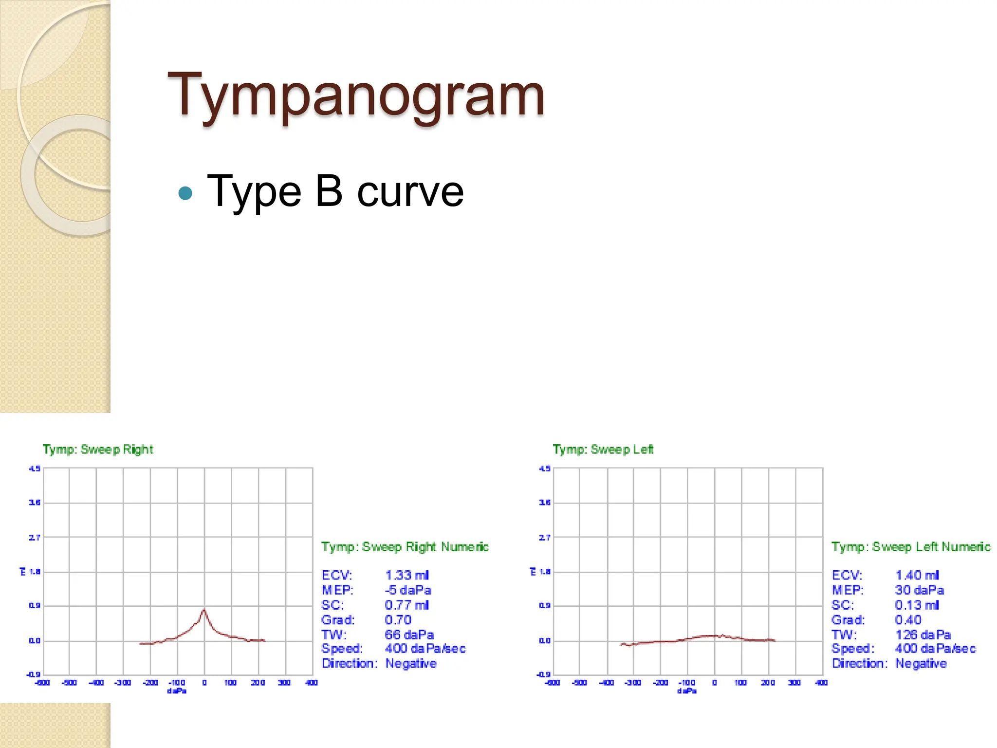 Otitis Media ppt .pptx