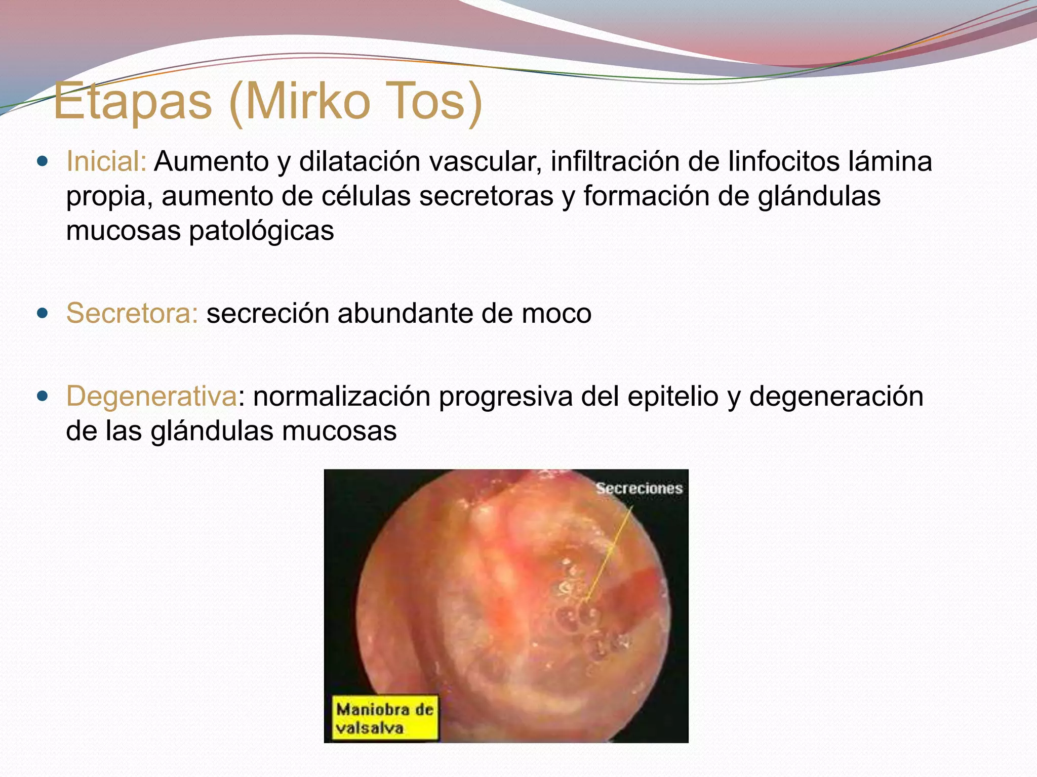 Otitis media serosa | PPTX