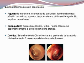 Otitis media serosa | PPT