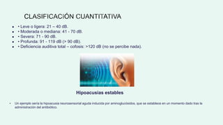 Otitis media serosa.pptx