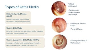 Otitis Media, The Common Cold, Tonsillitis & Peritonsillar Abscess | PDF