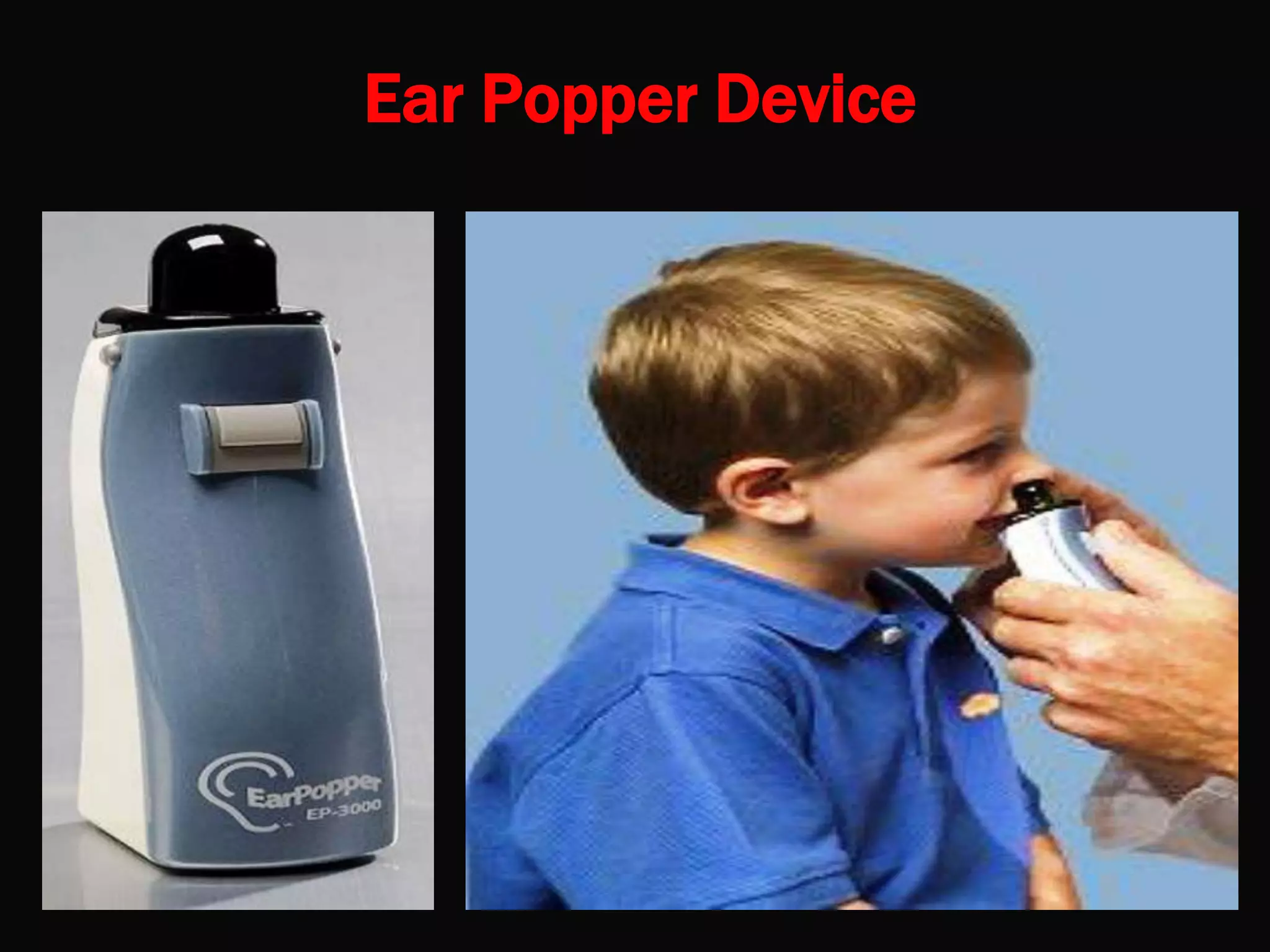 Otitis Media With Effusion (OME) | PPT