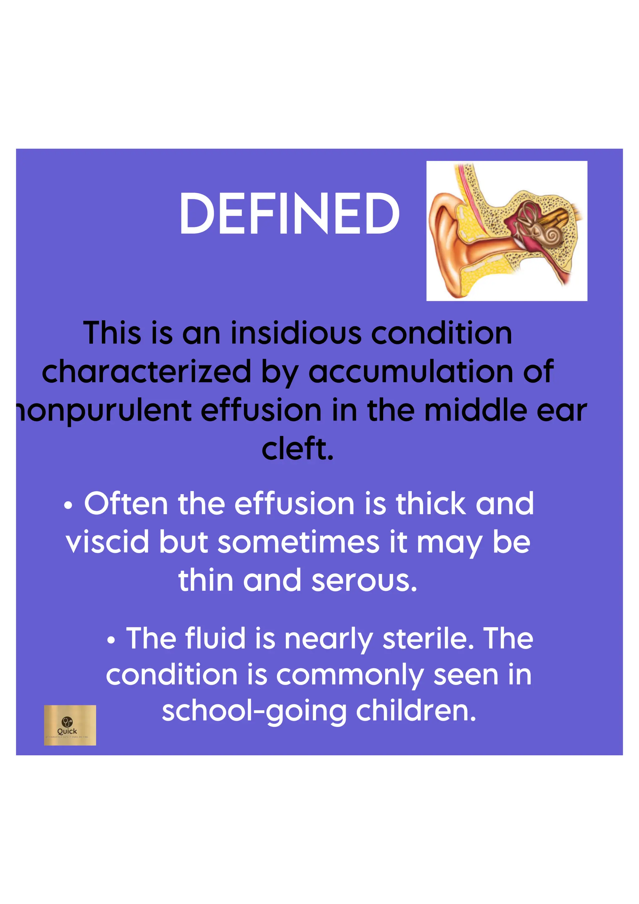 Otitis media with effusion .pdf ENT BY QUICKMEDTALK | PDF