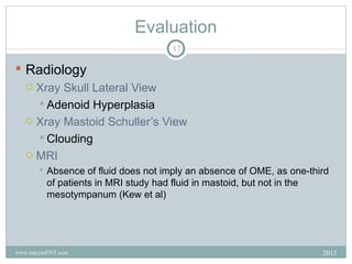 Otitis media with effusion ome | PPT