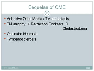 Otitis media with effusion ome | PPT