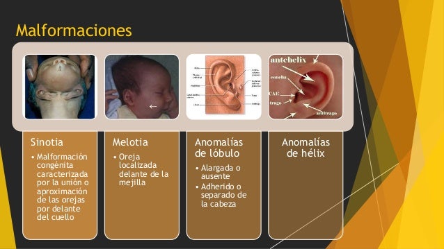 Otitis y malformaciones
