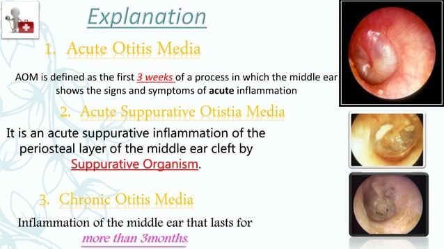OTITIS MEDIA | PPTX | Ear, Nose and Throat Conditions | Diseases and ...