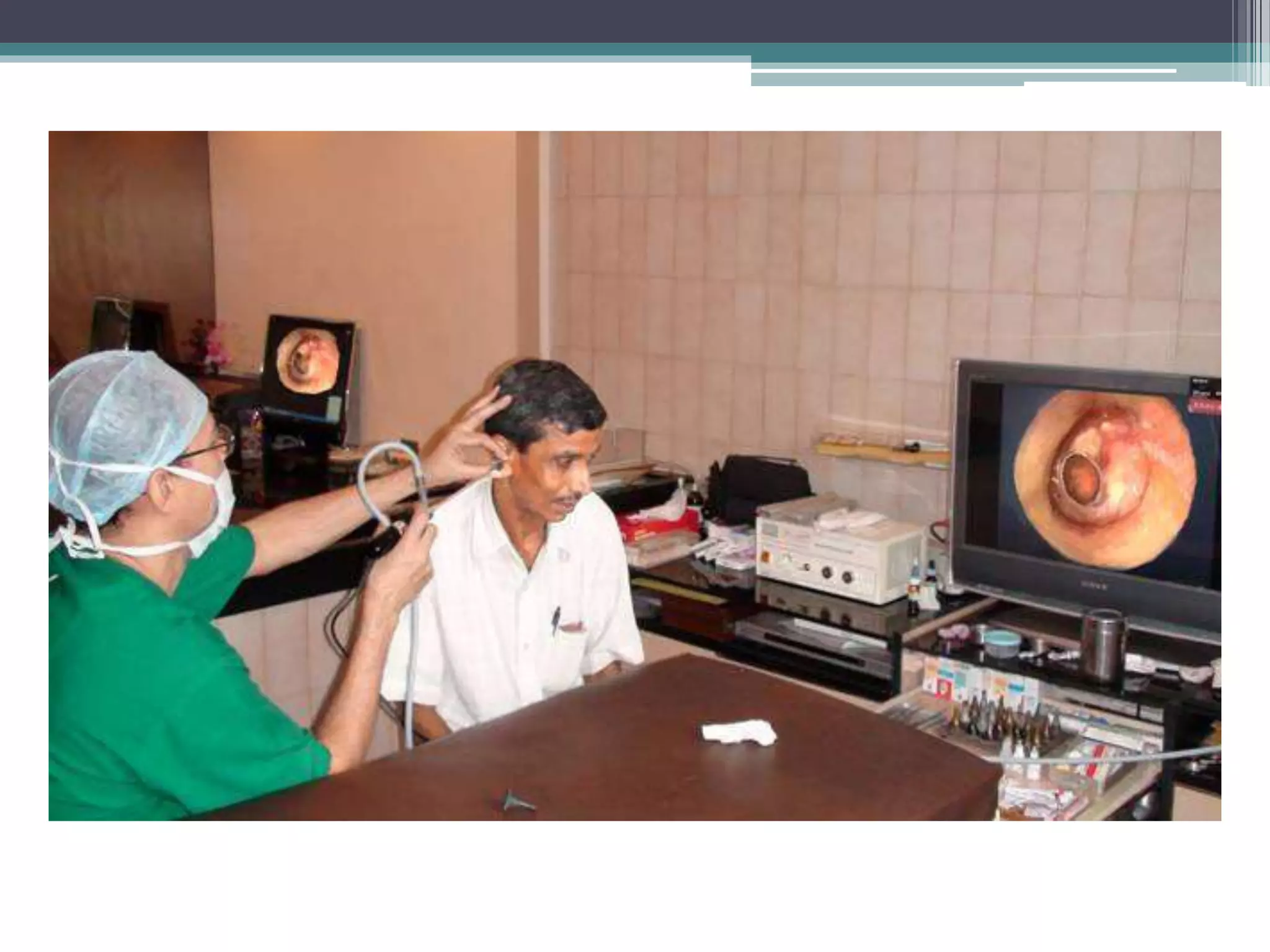 Otoendoscopy - Types, Uses, Procedures performed, Advantages and ...