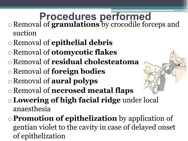 Otoendoscopy - Types, Uses, Procedures performed, Advantages and ...