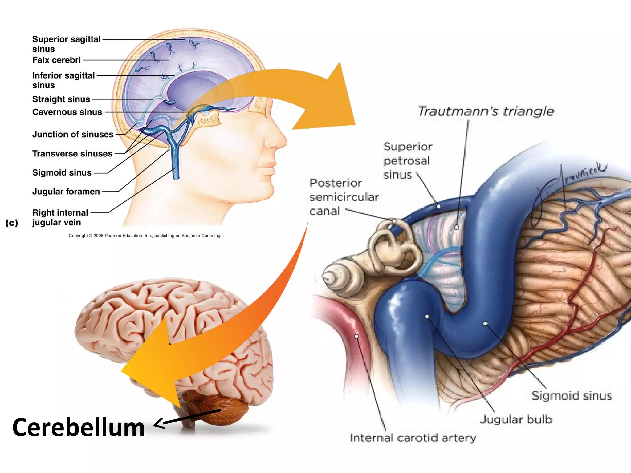 Otogenic brain abscess.pptx