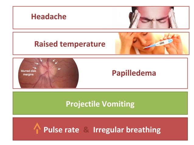 Otogenic brain abscess.pptx