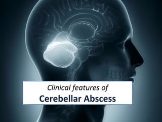 Otogenic brain abscess.pptx