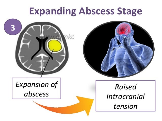 Otogenic brain abscess.pptx