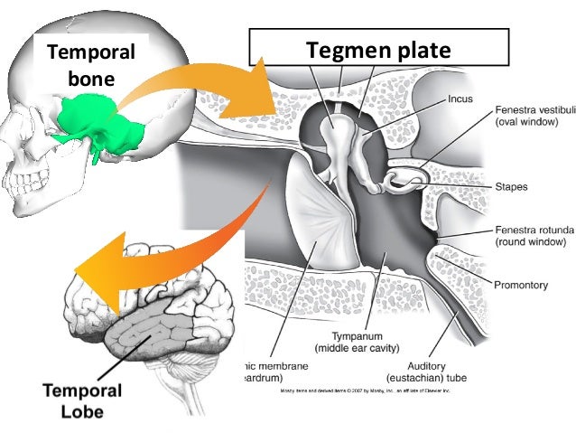 Otogenic brain abscess.pptx