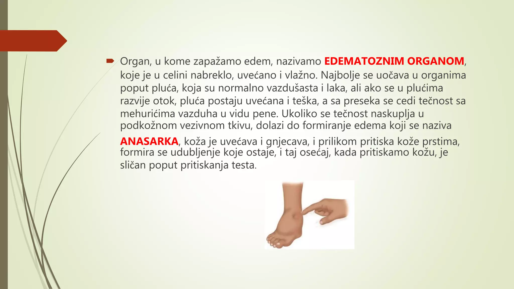 Otok (oedema) | PPTX