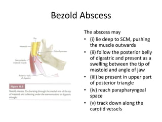 OTOLOGY POINTS & Post-auricular abscesses.pptx