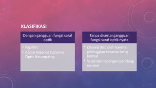 otomotiv edema papil dan teman tame.pptx