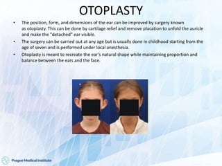 Otoplasty surgery in Prague Medical Institute | PPTX