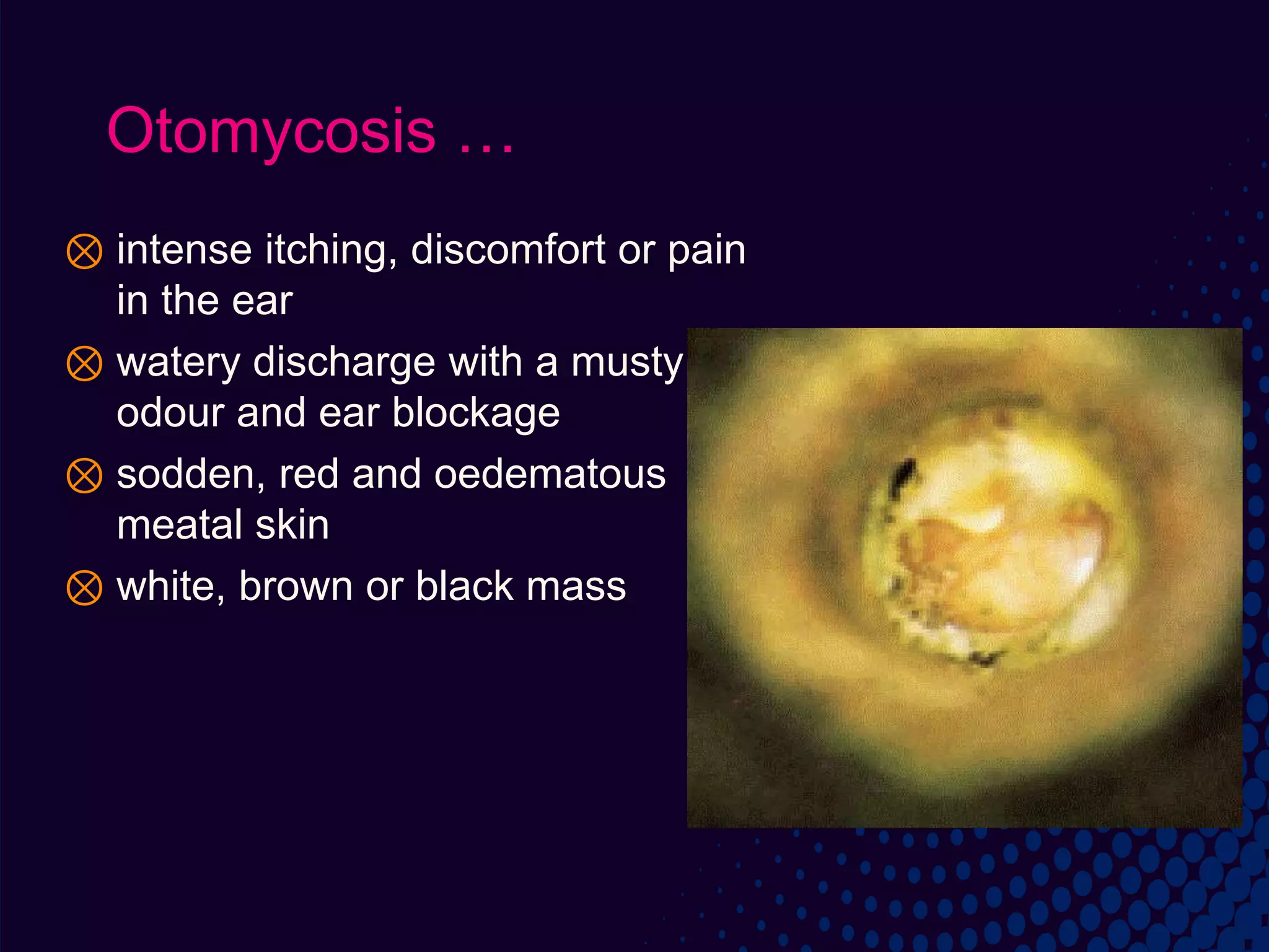 Otorhinolaryngology | PPTX