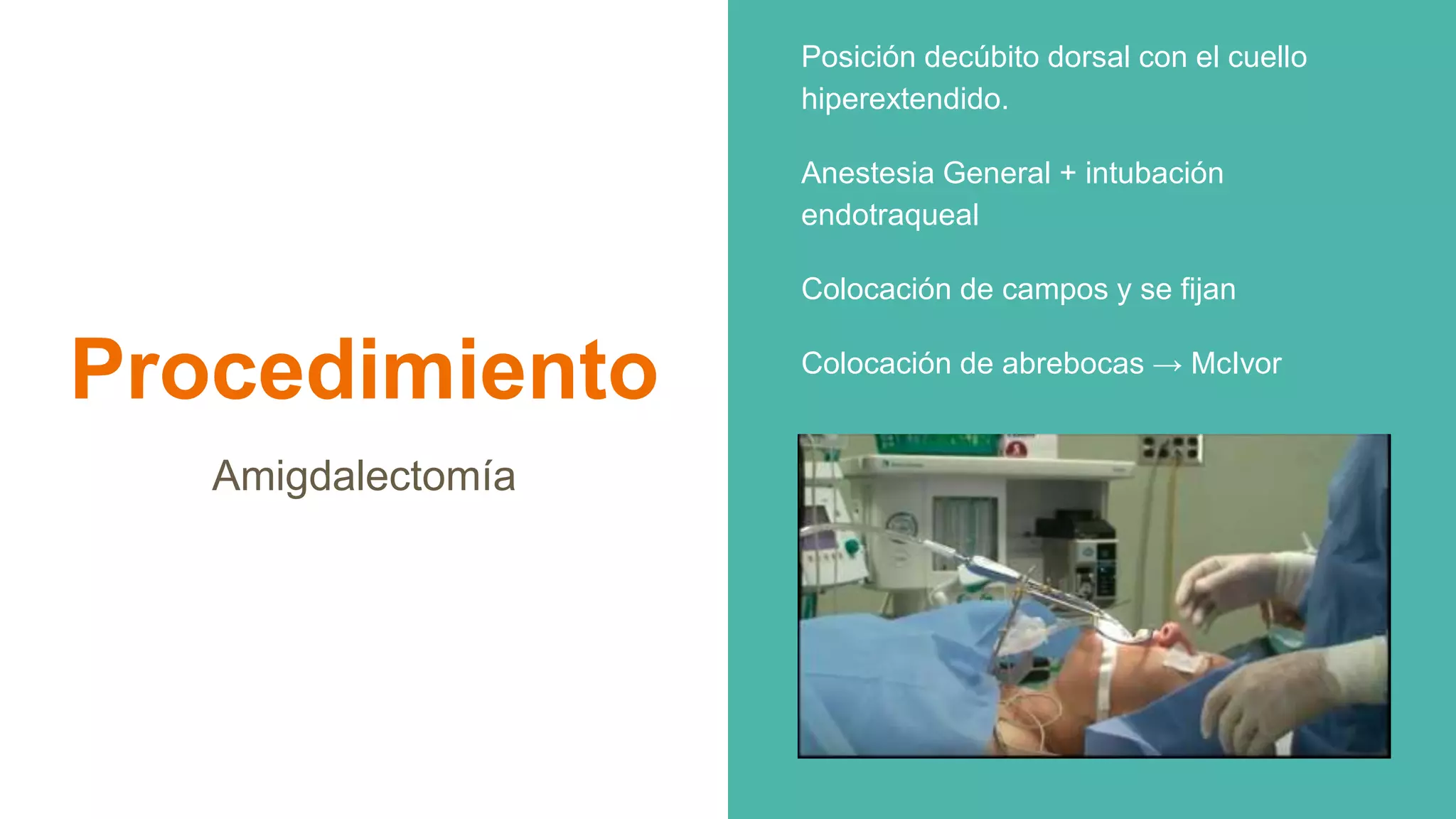 Amigdalectomia & Adenoidectomia | PPTX