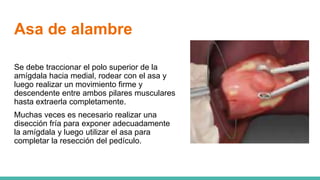 Amigdalectomia & Adenoidectomia | PPTX