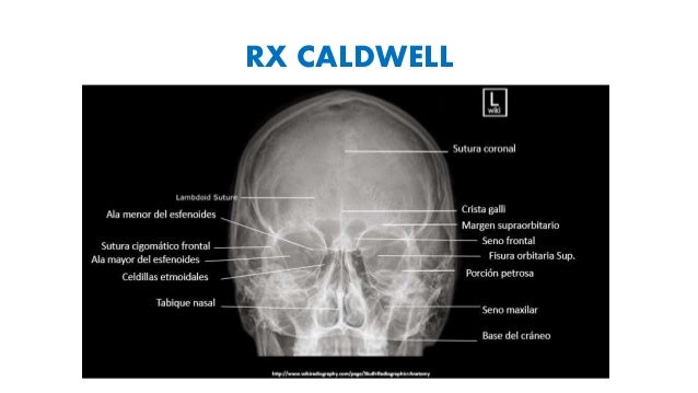 Otorrinolaringología Patologias de la Nariz