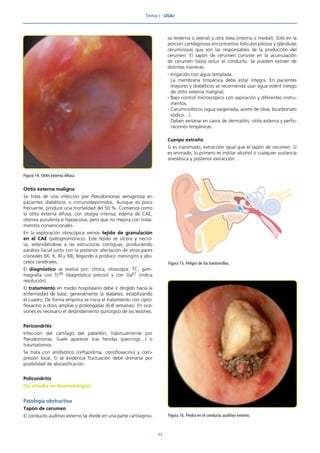 Otorrinolaringología AMIR 15° ed - Mexico (16) 2022.pdf