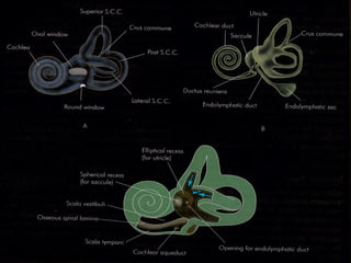 Otosclerosis | PPT | Free Download