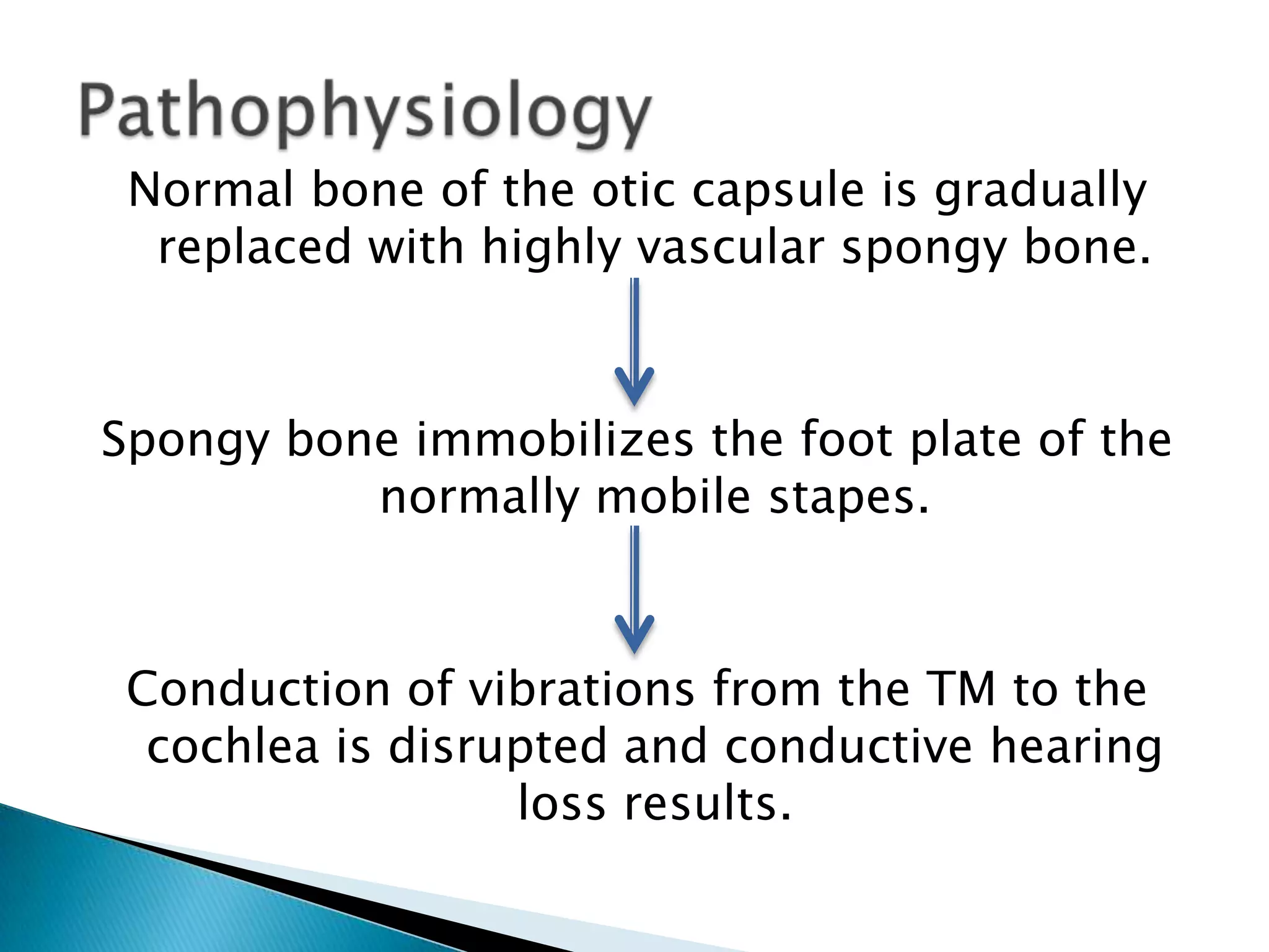 Otosclerosis | PPTX