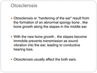 Otosclerosis | PPTX