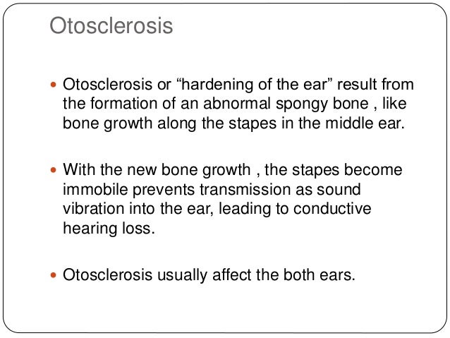 Otosclerosis