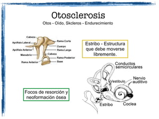 Otosclerosis: causas, síntomas y tratamiento de la enfermedad del ...