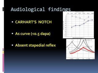 Otosclerosis | PPTX