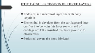 Otosclerosis | PPT