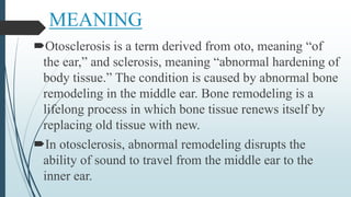 Otosclerosis | PPTX