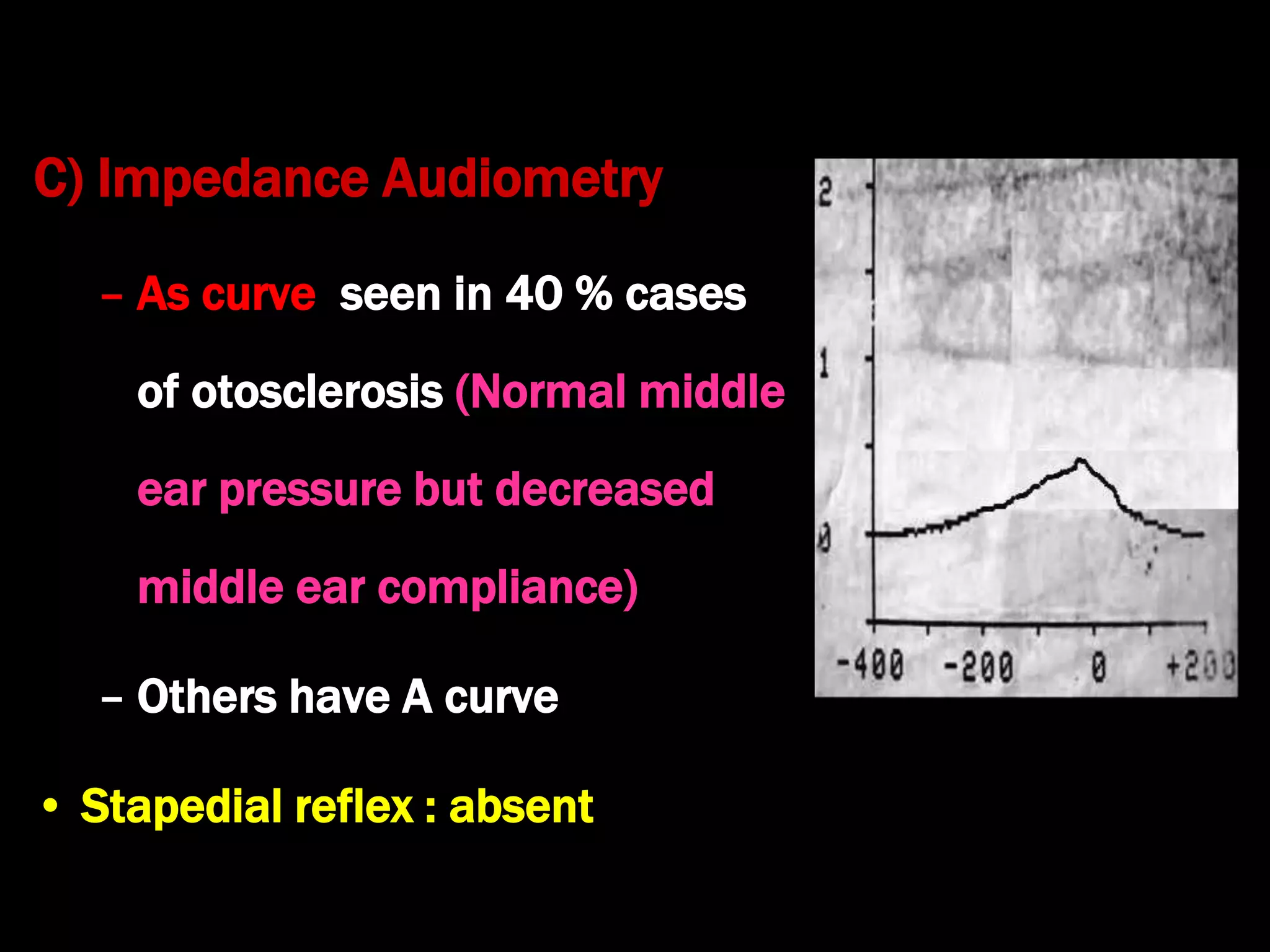 Otosclerosis | PPT