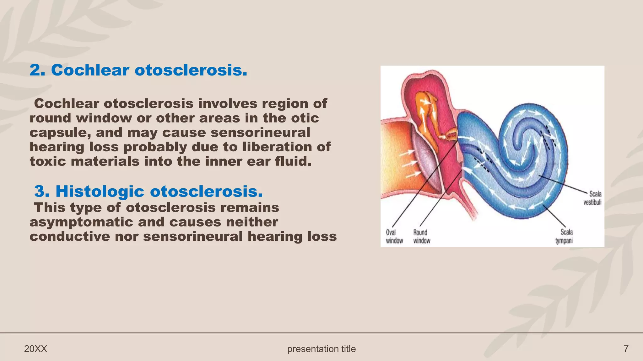OTOSCLEROSIS | PPTX