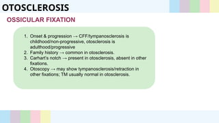 otosclerosis- history, pathology, stapedectomy | PPTX