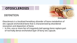 otosclerosis- history, pathology, stapedectomy | PPTX