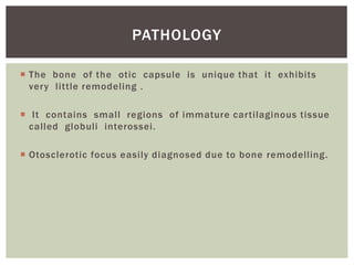 Otosclerosis | PPTX