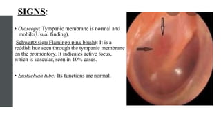 Otosclerosis and its management.pdf
