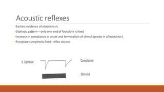 Otosclerosis - Arjun Antony Graison | PPT