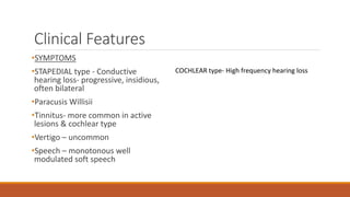 Otosclerosis - Arjun Antony Graison | PPT