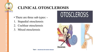 Otosclerosis & meniere's disease ppt for nursing students | PPTX