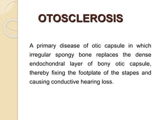 Otosclerosis dr.p.kartyhikeyan,07.03.2016